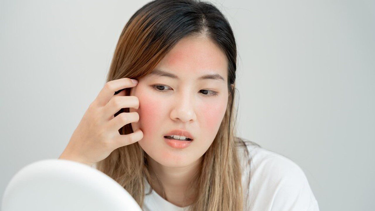 Difference Between Skin Purging and Regular Acne – SEDIOUR